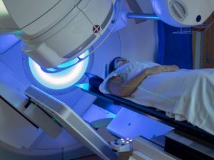 How to cope with side effects of Radiation Therapy? - Health changing